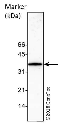 Anti-T7 tag antibody (GTX128059) | GeneTex