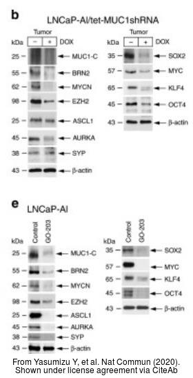 Anti-ASCL1 antibody (GTX129189) | GeneTex