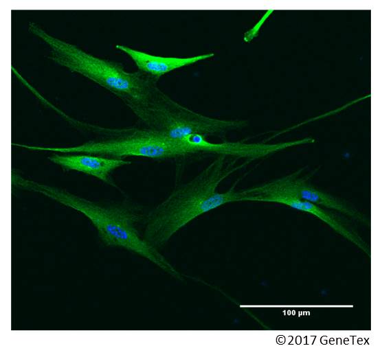 Anti-beta Tubulin 3/ Tuj1 antibody (GTX129913) | GeneTex