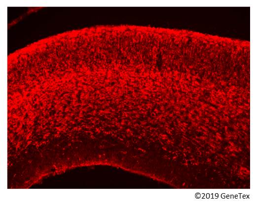 Anti-beta Tubulin 3/ Tuj1 antibody (GTX130245) | GeneTex