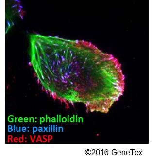 Anti-VASP antibody (GTX132176) | GeneTex