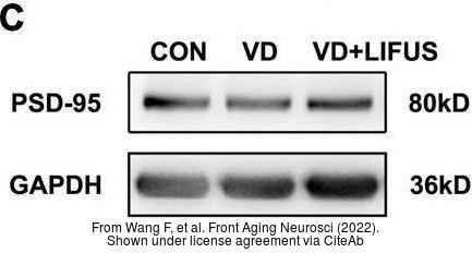 Anti-PSD95 antibody (GTX133091) | GeneTex