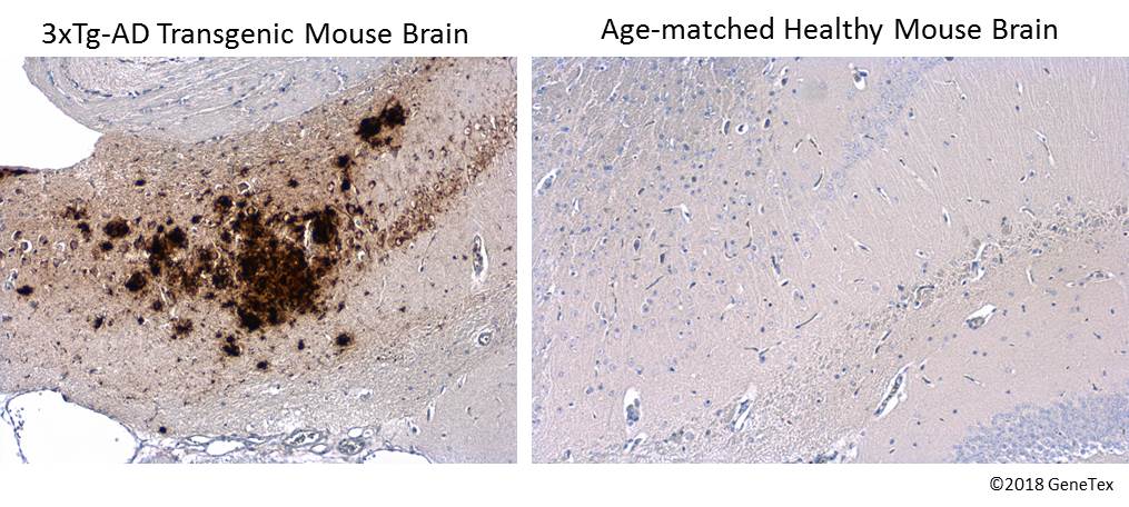 Anti-beta Amyloid (1-42) antibody – Conformation Specific (GTX134510) | GeneTex