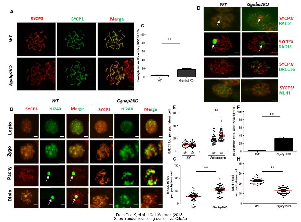 Anti-SCP3 antibody (GTX15092) | GeneTex