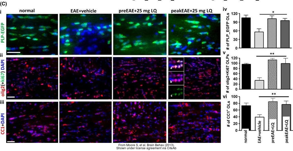 Anti-APC antibody [CC-1] (GTX16794) | GeneTex