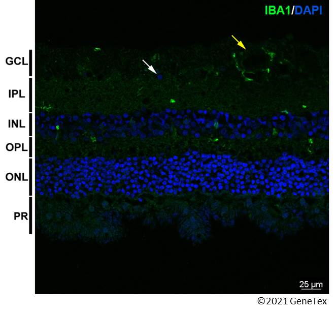 Human Eye: Retina (Normal) tissue slides (GTX22016) | GeneTex