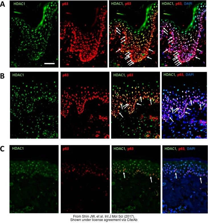 Anti-p63 antibody [4A4] (GTX23239) | GeneTex