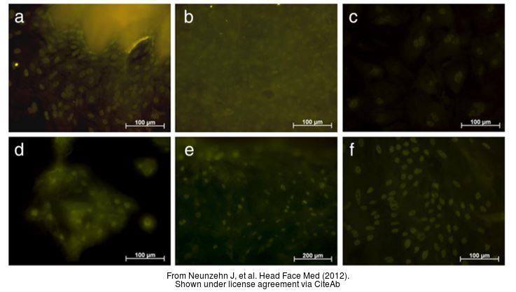 Anti-p63 antibody [4A4] (GTX23239) | GeneTex