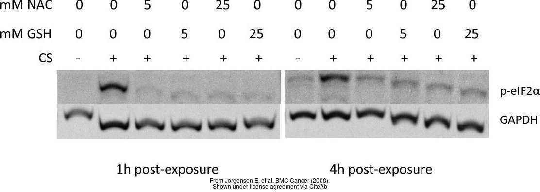 Anti-eIF2 alpha (phospho Ser51) antibody (GTX24837) | GeneTex