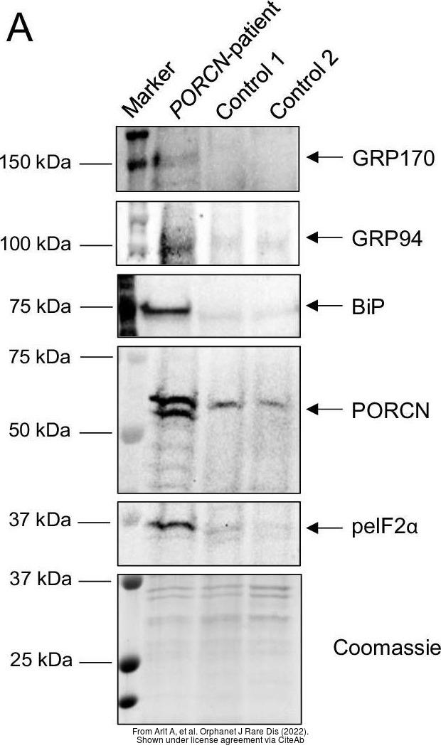 Anti-eIF2 alpha (phospho Ser51) antibody (GTX50300) | GeneTex