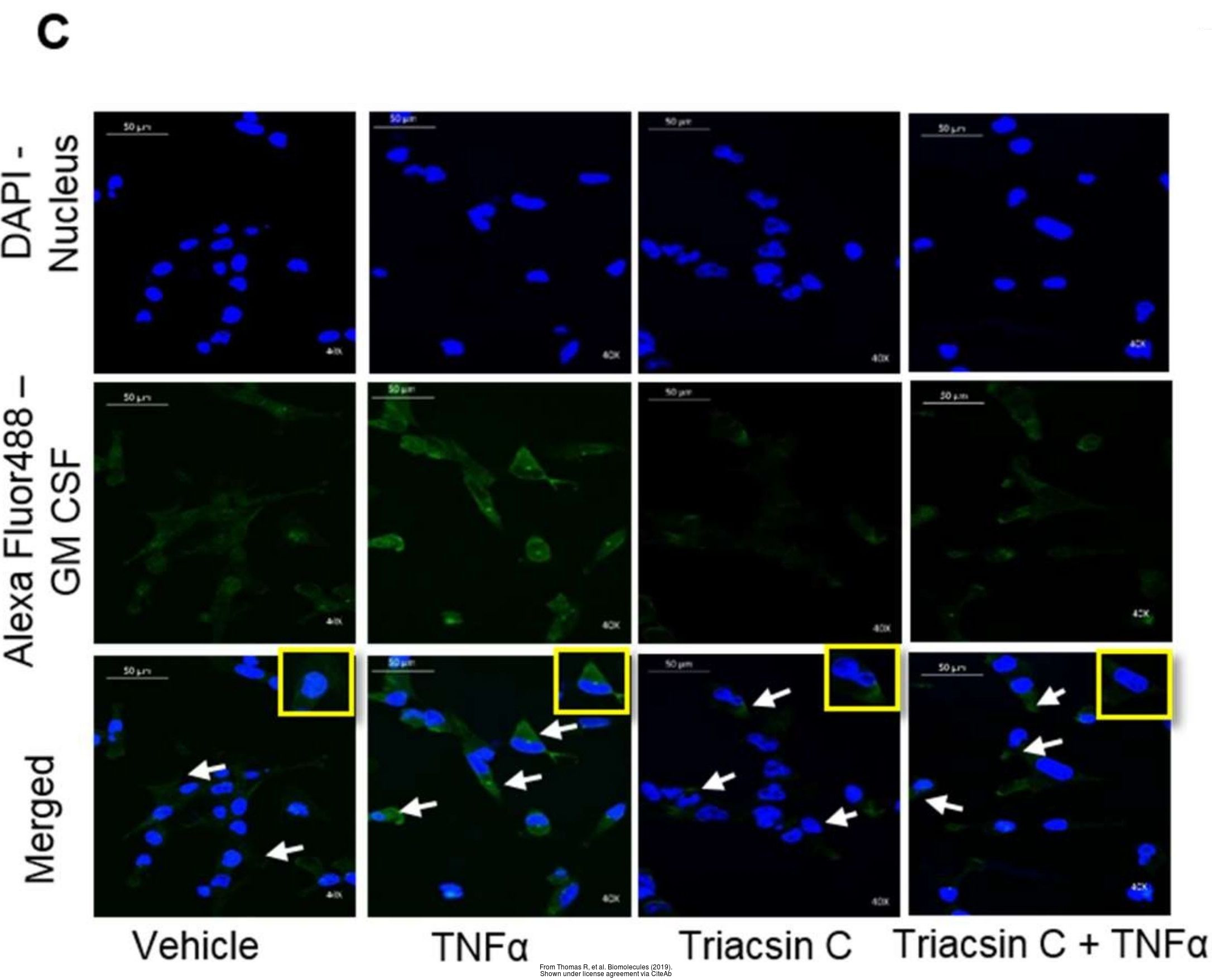 Anti-GM-CSF Receptor alpha antibody (GTX51383) | GeneTex