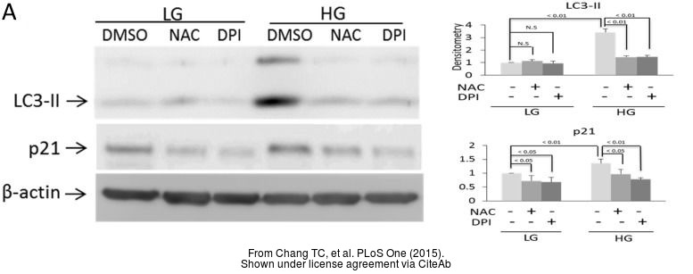 Anti-p21 Cip1 antibody [GT1032] (GTX629543) | GeneTex