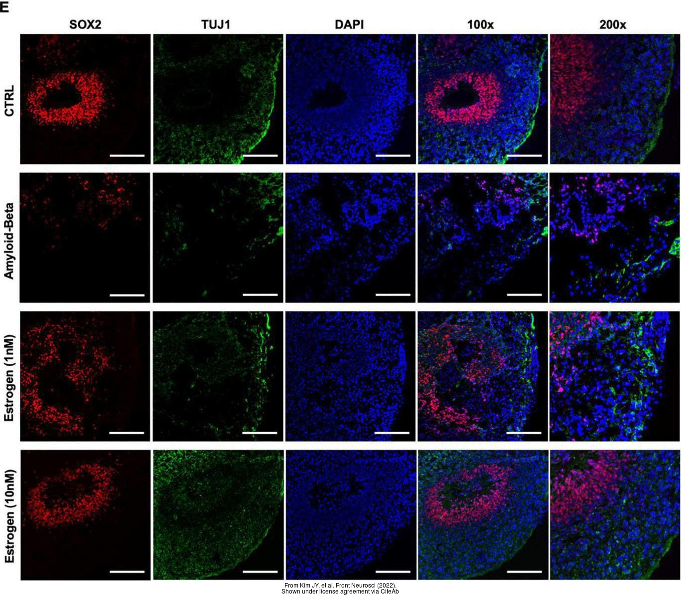 Anti-beta Tubulin 3/ Tuj1 antibody [GT11710] (GTX631836) | GeneTex