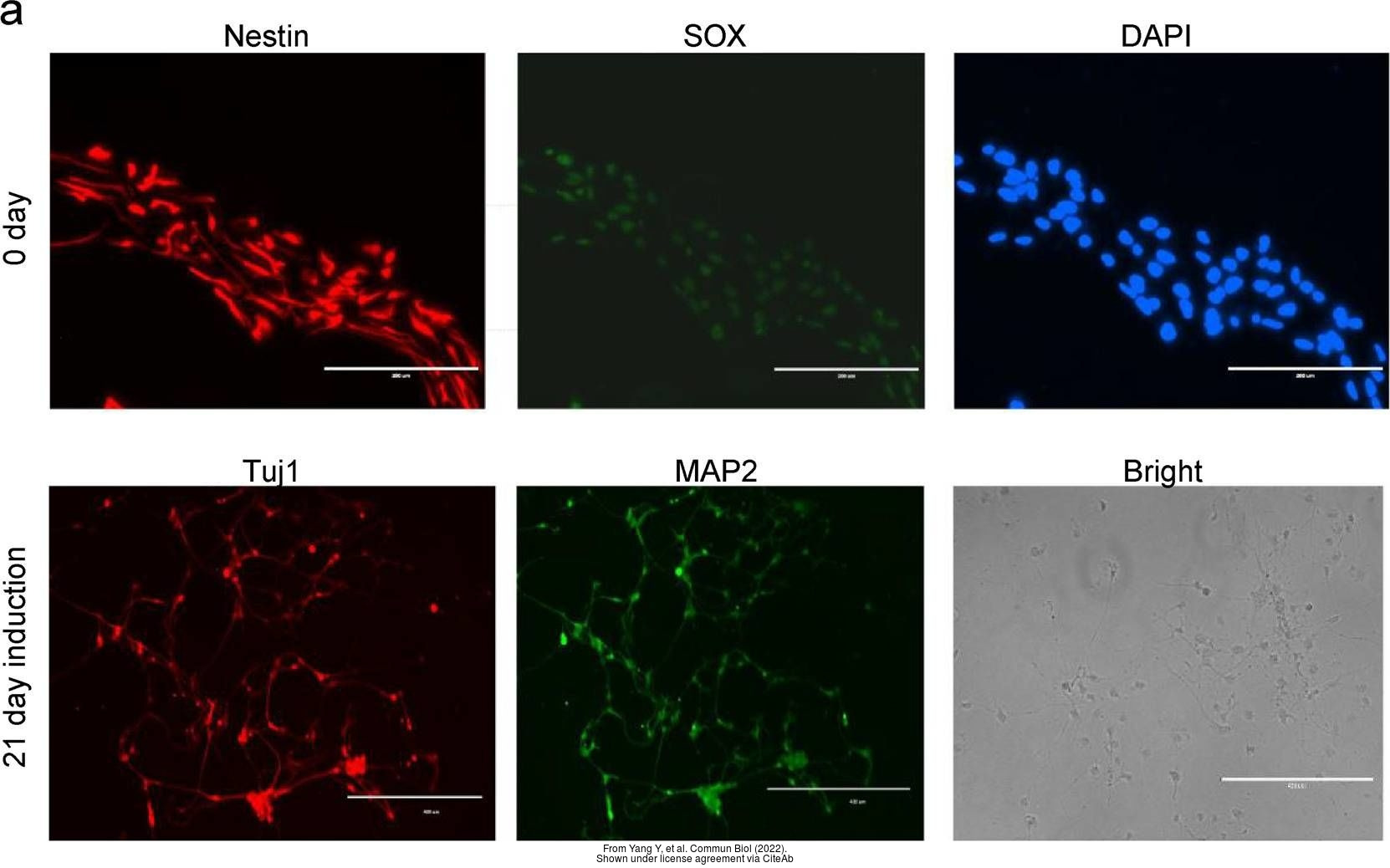 Anti-beta Tubulin 3/ Tuj1 antibody [GT11710] (GTX631836) | GeneTex
