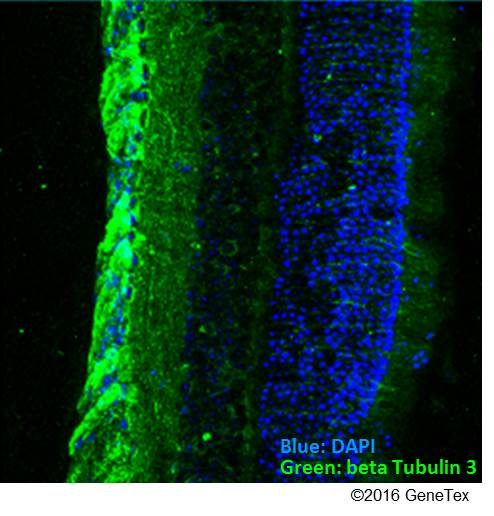 Anti-beta Tubulin 3/ Tuj1 antibody [GT11710] (GTX631836) | GeneTex
