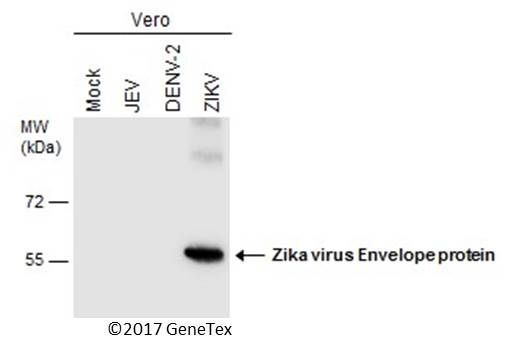 Anti-Zika virus Envelope protein antibody [GT363] (GTX634155) | GeneTex