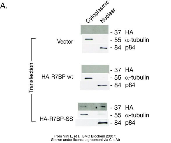 Anti-Nuclear Matrix Protein p84 antibody [5E10] (GTX70220) | GeneTex