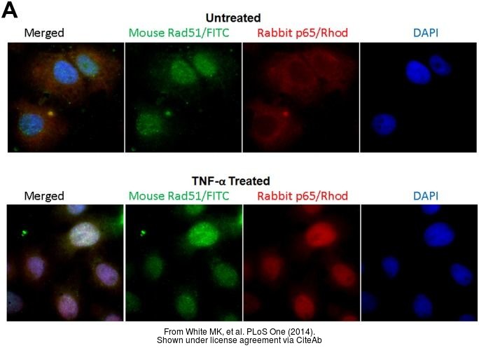 Anti-Rad51 antibody [14B4] (GTX70230) | GeneTex