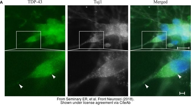 Anti-beta Tubulin 3/ Tuj1 antibody (GTX85469) | GeneTex