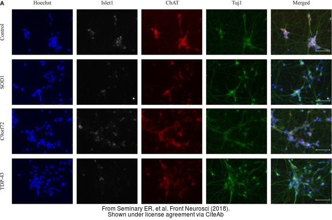 Anti-beta Tubulin 3/ Tuj1 antibody (GTX85469) | GeneTex